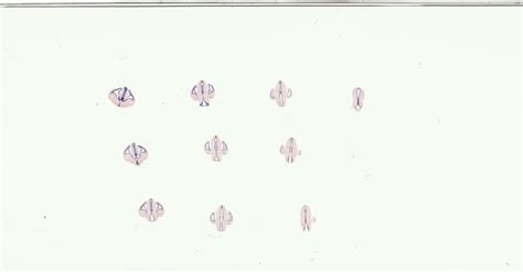 Nectin3 Rna In Situ Gene Expression Assay Gxd