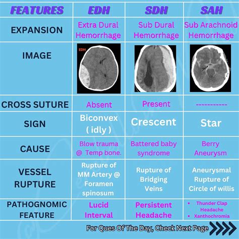 𝓒𝓮𝓻𝓮𝓫𝓻𝓾𝓶 𝓜𝓮𝓭 📌surgery Flashcard 📝 📌topic Edh Vs Sdh Vs Sah 📌fmge