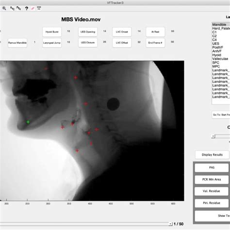 The Graphical User Interface And Functions Of The Matlab Tracker Tool