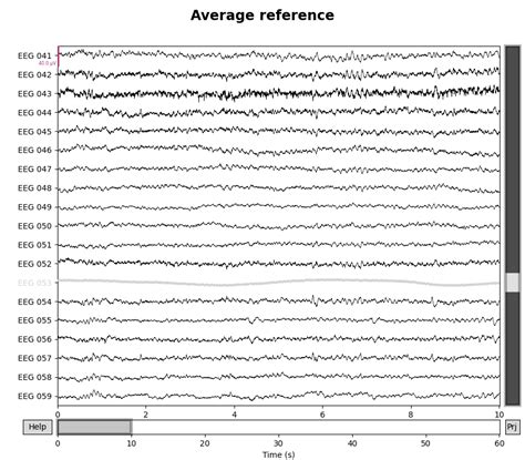 Setting The Eeg Reference — Mne 1101 Documentation