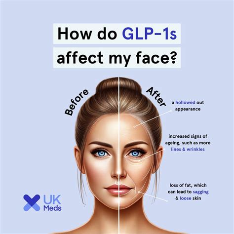 Uk Meds 🤔 How Do Glp 1s Affect Your Face While Glp 1s Facebook