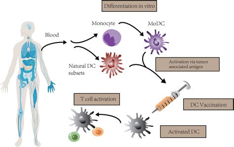 How Dendritic Cell Therapy Is Transforming Cancer Treatment Vent Magazines