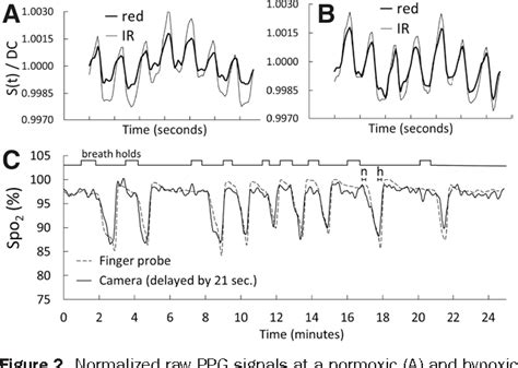 Figure 1 From Calibration Of Contactless Pulse Oximetry Semantic Scholar