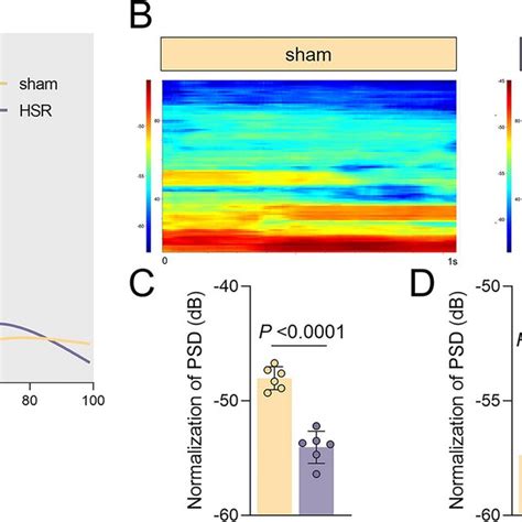 Lfp In The Mpfc Under Exploratory Conditions Showed That Beta Power Was