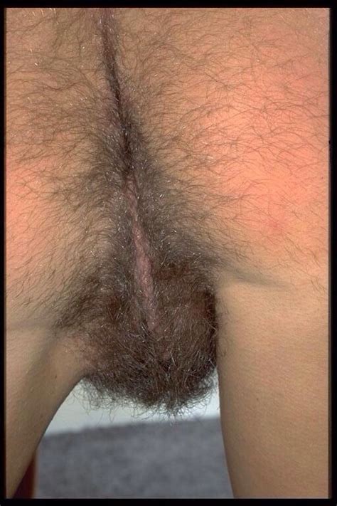 Hairyturkishwomen Tumblr Com Tumbex