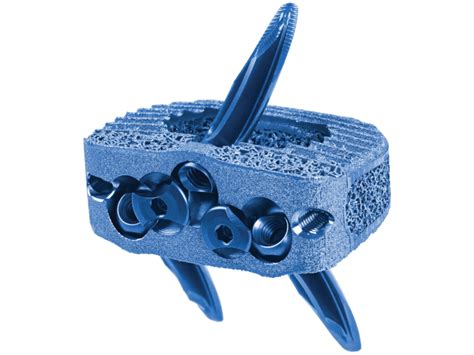 Anterior Lumbar Globus Medical