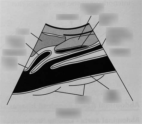 Aorta Sag Mid Diagram Quizlet