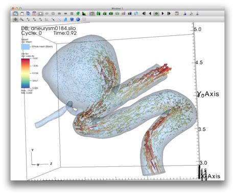 Blood Flow Aneurysm Tutorial Vector Field Visualization VisItusers Org
