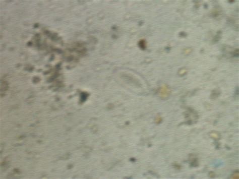 Enterobius Vermicularis Object Detection Dataset By Satish Kumar