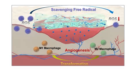 Thermosensitive Hydrogel Loaded With Nickelcopper Bimetallic Hollow