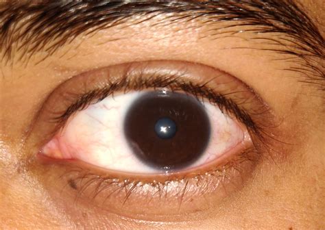Russet Colored Eyes