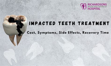 Impacted Teeth Treatment Cost Symptoms Side Effects Recovery Time