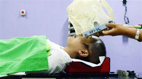 Efek Samping Radioterapi Bagi Pasien Kanker