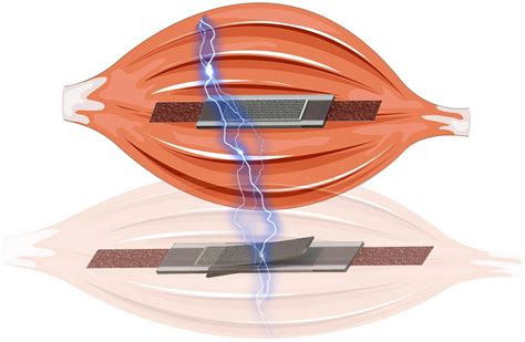 Bionic Breakthrough Revolutionary Self Sensing Electric Artificial Muscles