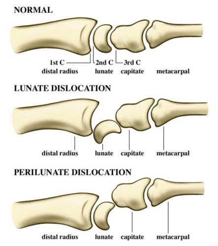 The Wrist And Hand Flashcards Quizlet