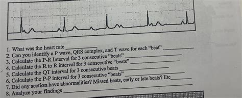 Solved What Was The Heart Rate Can You Identify A P Chegg Com
