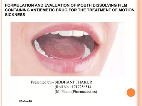 Formulation And Evaluation Of Mouth Dissolving Film Containing Antiemetic Drug For The Treatment