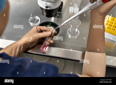 Expert In Brown Latex Gloves Takes Material From The Test Tube During The In Vitro Fertilization