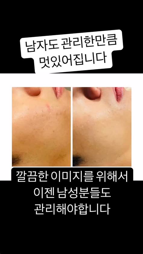 신사피부관리 강남피부관리 이지슬림스파 🤙피부가 좋지도 나쁘지도 않고 그져 칙칙하고 활력도 없을때 피부도 터닝포인트가 필요합니다 👺한번 각질층을 필링을 통해 탈락을 시킨후