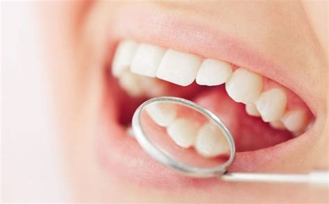 Black Fillings Adelaide Dental