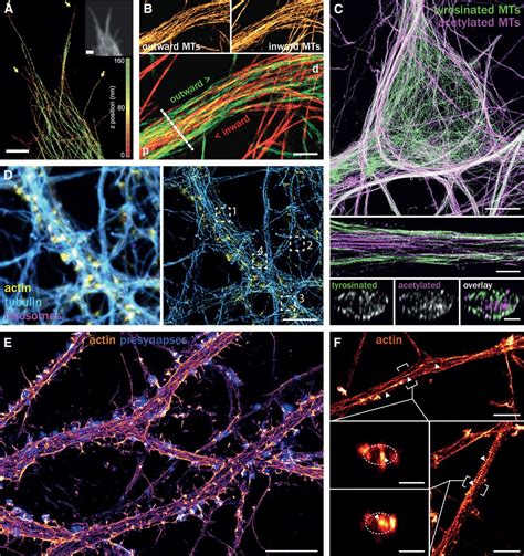 Cytoskeleton Electron Micrograph