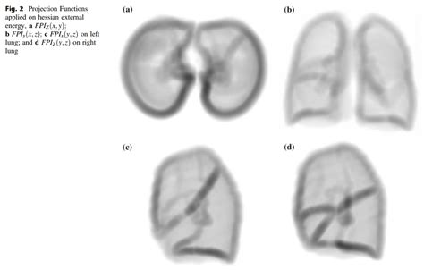 Automatic Initialization Of 3d Active Models For Lobe Segmentation In Thorax Ct Images Nuven