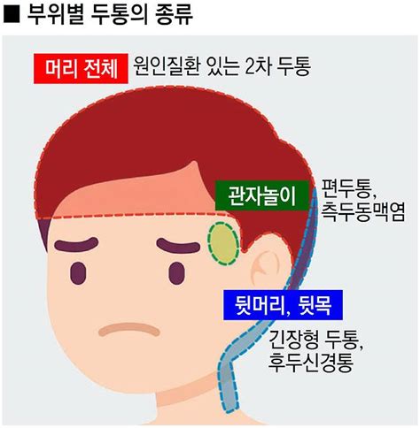 머리 전체가 깨질 듯 아플 땐 즉시 병원으로 가세요”