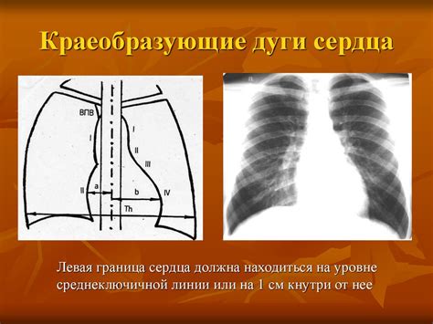 Рентгеноанатомия сердца и крупных сосудов презентация онлайн