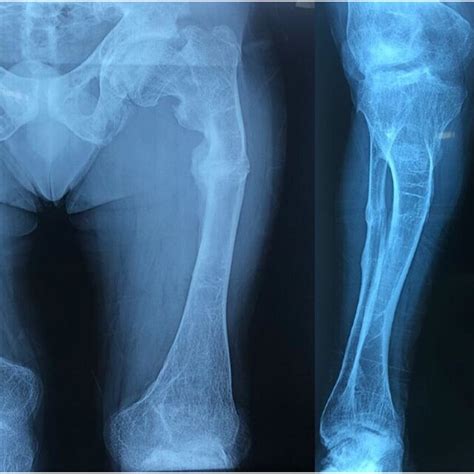 Genetic Study Electropherogram Download Scientific Diagram