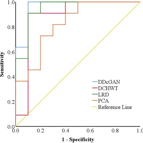 Roc Curve Of Different Fusion Methods For Glioma Grade Classification