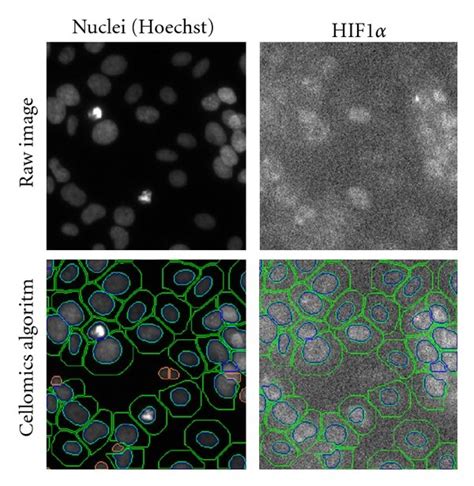 Cellomics Images Showing The Algorithm Used For Quantification Of