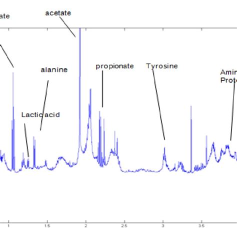 Median 1 H Nmr Spectra Derived From Saliva Of Healthy Controls