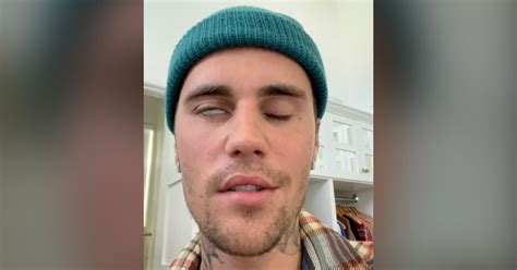 Bieber Says Faith In Jesus Has Given Peace Amidst His Facial Paralysis