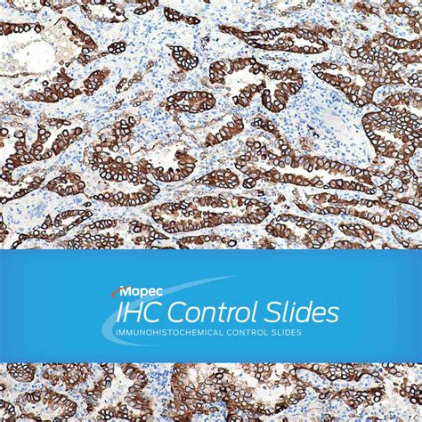 Ihc Control Slides Mopec