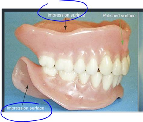 Rcd Midterm L3 Theory Identify Anatomical Landmarks In Edentulous Patients Flashcards Quizlet
