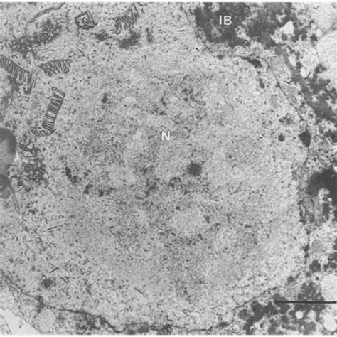 Electron Micrographs Of Thin Sections Prepared From Recombinant