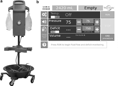 Figure 1 From Prospective Randomized Comparison Of Standard Hand Pump Infuser Irrigation Vs An