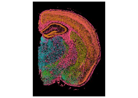 Prepare For The Next Section