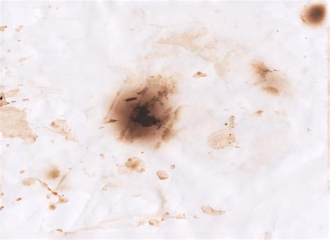 75000 Staining With Stains Pictures