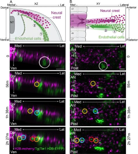 Time Lapse Analysis Reveals A Multistep Sequence To The Neural Crest Download Scientific