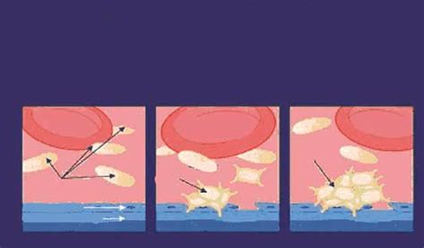 The Steps Involved In Clot Formation Download Scientific Diagram