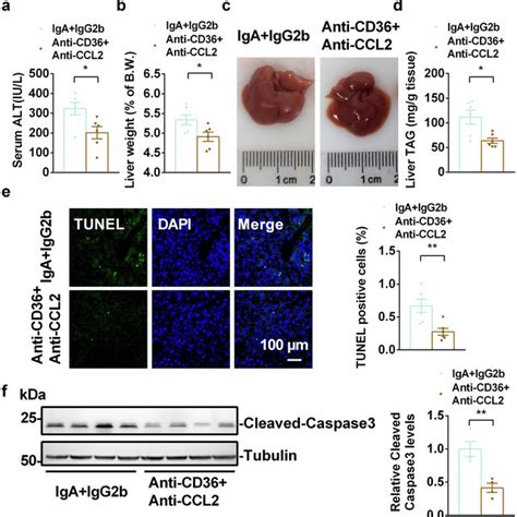 Liver Specific Knockout Of Mettl3 Accelerates Diet Induced Liver