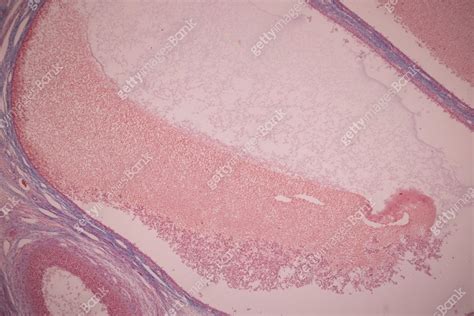 Anatomy And Histological Ovary And Testis Human Cells Under Microscope 이미지 1344422033 게티이미지뱅크