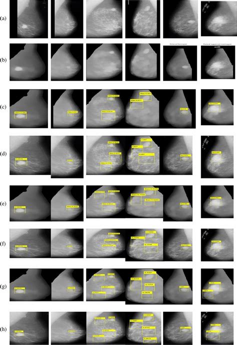 Mass Detection Results Produced By Different Object Detection Download Scientific Diagram