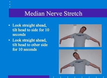1000 Images About Nerve Compression On Pinterest