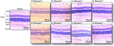 Representative Light Micrographs 15 Days After Intravitreal Injection