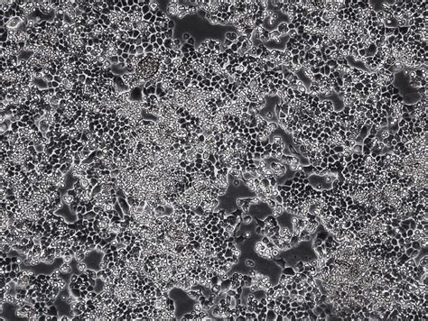 Oricell®c 33 A 人宫颈癌细胞系 价格 厂家 科研试剂 Oricell品牌 赛业（广州）生物科技