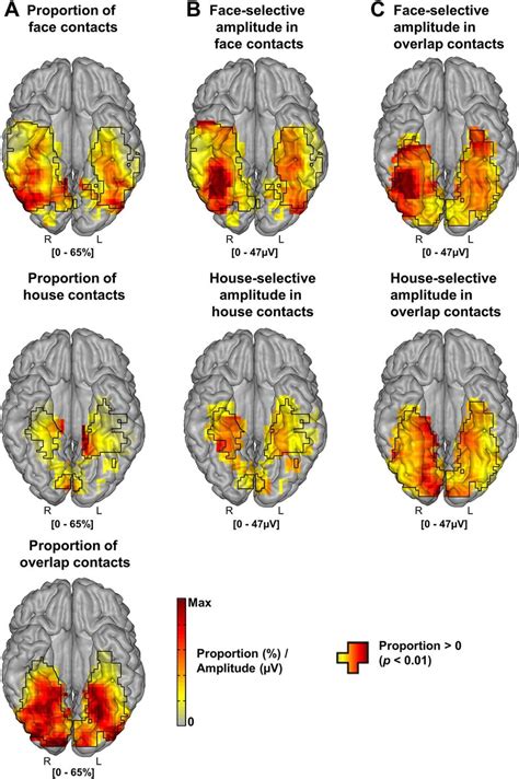 Proportion And Amplitude Maps A Maps Of The Local Proportion Of