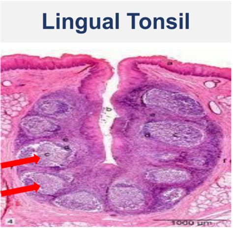 Tubal Tonsils Histology