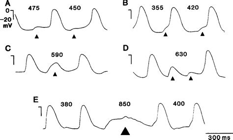 Figure 6 From Sinus Node Automaticity During Atrial Fibrillation In Isolated Rabbit Hearts
